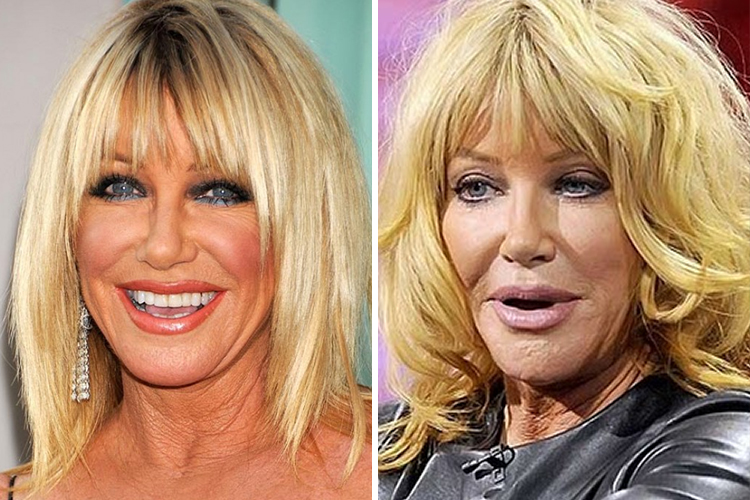 23 Most Expensive Celebrity Plastic Surgeries – IykBethany Gist Ville